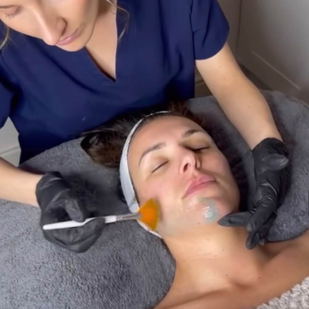 Thread Veins - Cheshire Treatment Lounge